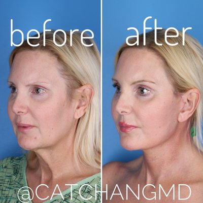 CATHERINE CHANG - Updated December 2025 - 13 Photos & 35 Reviews - 9735 ...