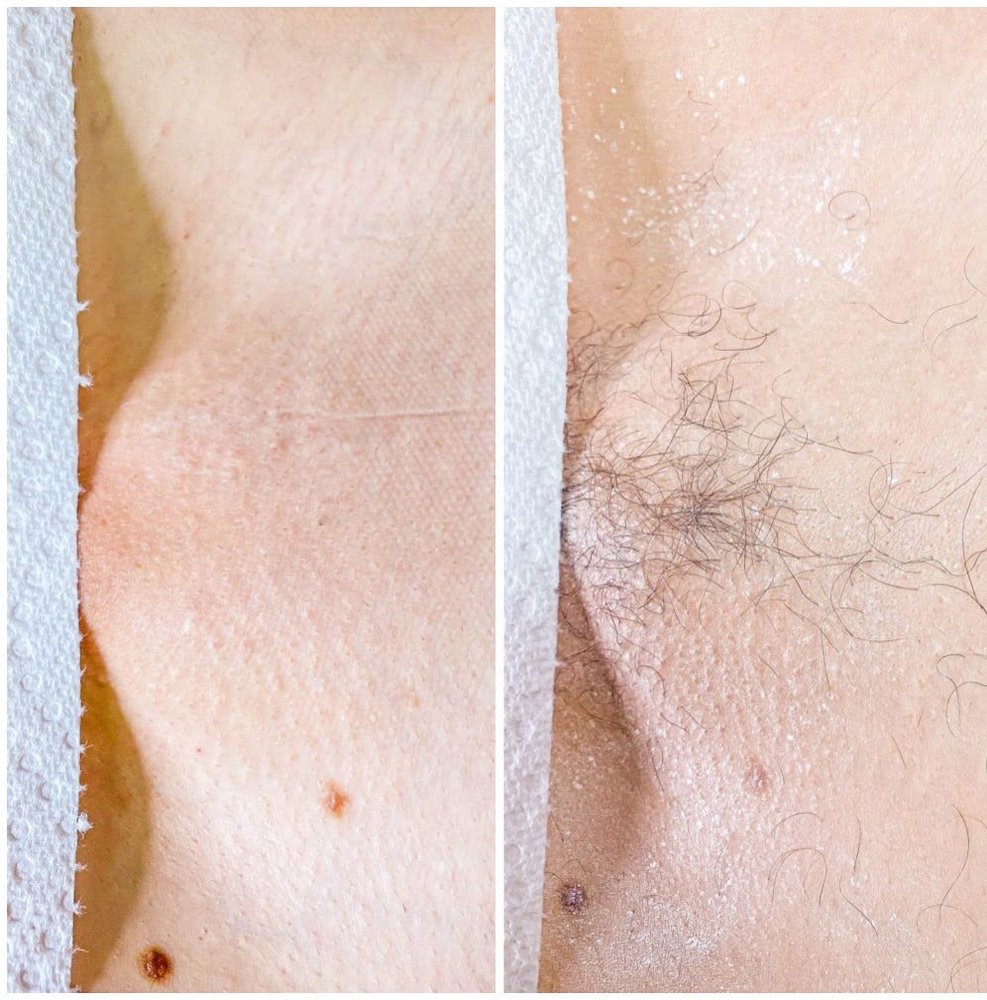 GINGER SUGARING - Request an Appointment - 31 Photos - 347 5th Ave, New York, New York ...