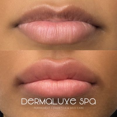 DERMALUXE SPA - Updated July 2024 - 124 Photos & 76 Reviews - 7670 ...