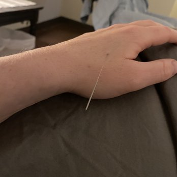 SOUTH AUSTIN COMMUNITY ACUPUNCTURE - Updated January 2026 - 25 Photos ...