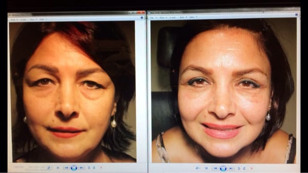 SOROUDI ADVANCED LASIK & EYE CENTERS - Updated December 2025 - 141 ...