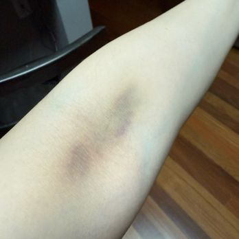 LABCORP - Updated December 2025 - 39 Photos & 133 Reviews - 2622 Ocean ...