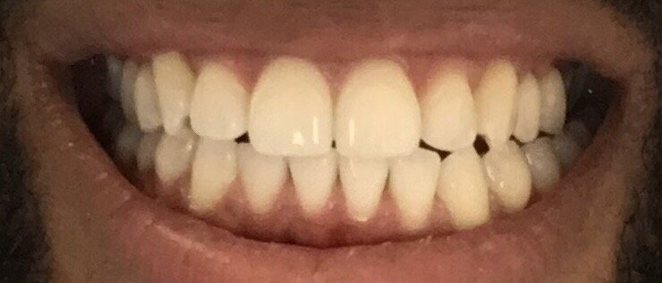 Seth Rosen, DDS - Trusted Since 2008 - Updated July 2025 - 16 Photos ...