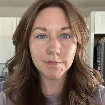 HI, SKIN - Updated September 2025 - 58 Photos & 74 Reviews - 100 E ...