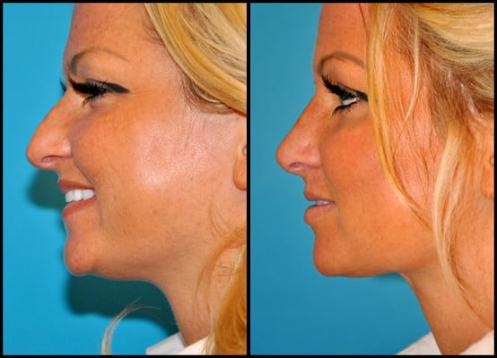 BARRY M. WEINTRAUB MD - Updated October 2025 - 64 Photos & 101 Reviews ...