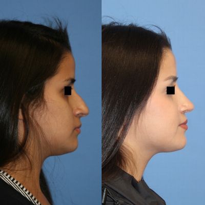 EVAN RANSOM, MD - Updated December 2025 - 126 Photos & 241 Reviews ...