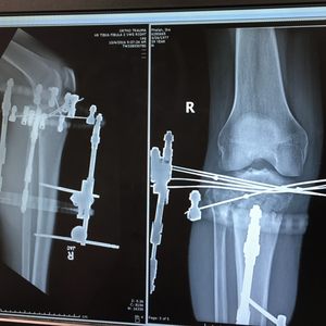 MARK L PRASARN, MD - Updated January 2025 - 11 Reviews - 6400 Fannin St ...