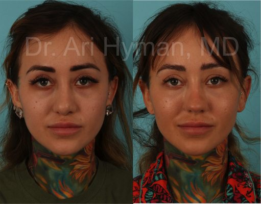 ARI HYMAN, MD - Updated October 2024 - 388 Photos & 57 Reviews - 16311 ...