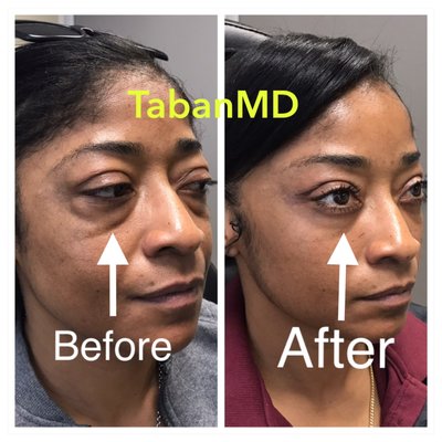 MEHRYAR RAY TABAN MD - OCULOPLASTIC SURGEON - Updated October 2025 ...