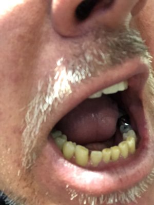 APPLE VALLEY DENTAL & BRACES - Updated December 2025 - 62 Reviews ...