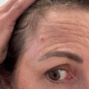 HI, SKIN - Updated September 2025 - 58 Photos & 74 Reviews - 100 E ...