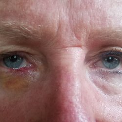 JEFFREY JOSEPH, MD - 36 Photos & 63 Reviews - Cosmetic Surgeons - 5010 ...