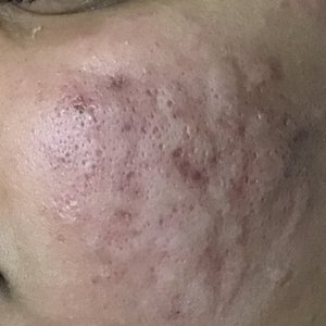 KUR SKIN LAB - 175 Photos & 620 Reviews - 875 3rd Ave, New York, NY - Yelp