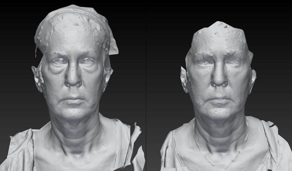 TIMOTHY R. MILLER, MD: REFRESHED AESTHETIC SURGERY - Updated July 2025 ...