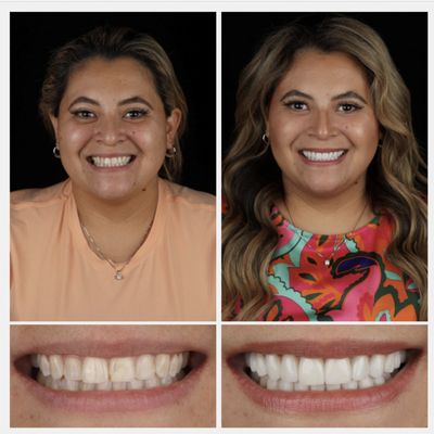 SMILE TEXAS - Updated December 2025 - 21 Photos & 15 Reviews - 4665 ...