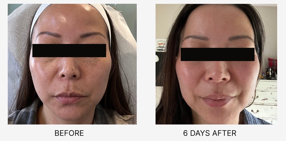 PETER CHANSKY, MD - Updated October 2025 - 45 Reviews - 3838 California ...