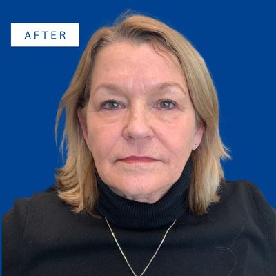 BRETT STOMPRO, MD & CHESTER CHENG, MD - Updated May 2024 - 240 Photos ...