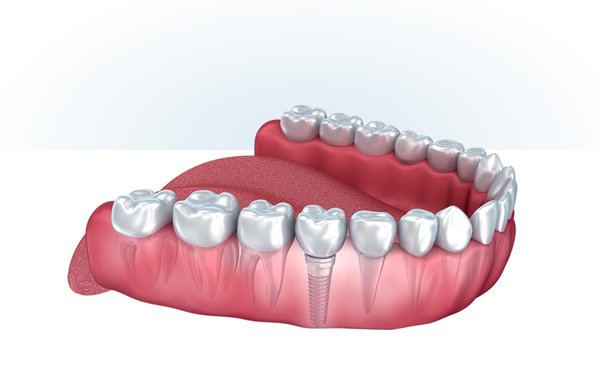 ORA DENTAL IMPLANT STUDIO - Updated October 2025 - 24 Photos & 10 ...