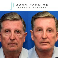 JOHN PARK MD PLASTIC SURGERY - 94 Photos & 74 Reviews - 180 Newport ...
