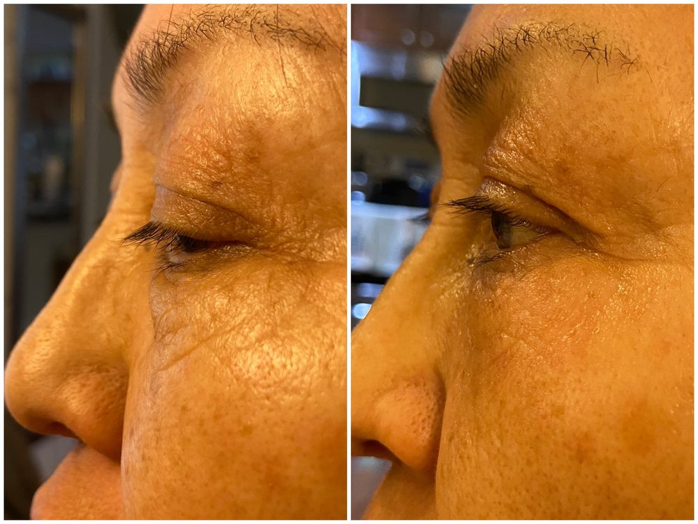 PROLASE MEDISPA - Updated July 2024 - 652 Photos & 32 Reviews - 3930 ...