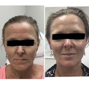 MELYSSA HANCOCK, MD - Updated February 2025 - 1601 Clint Moore Rd, Boca ...