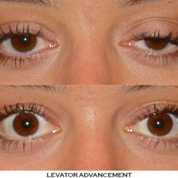 SOHEILA ROSTAMI, MD, FAAO, FAACS - 19 Photos & 16 Reviews - 1860 Town ...