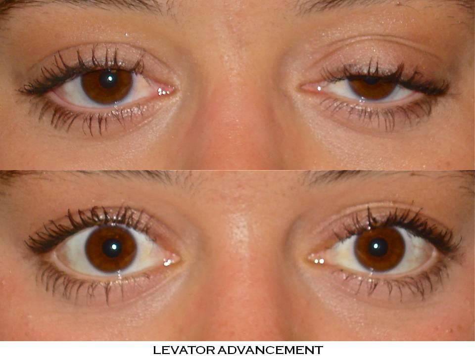 SOHEILA ROSTAMI, MD, FAAO, FAACS - Updated December 2025 - 19 Photos ...