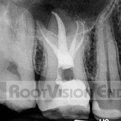 ROOTVISION ENDO - 42 Photos & 180 Reviews - 3663 Torrance Blvd ...