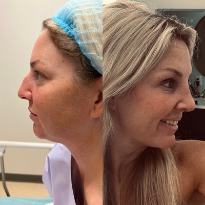 SAMIR S UNDAVIA, MD - Updated January 2026 - 73 Photos & 19 Reviews - 5 ...