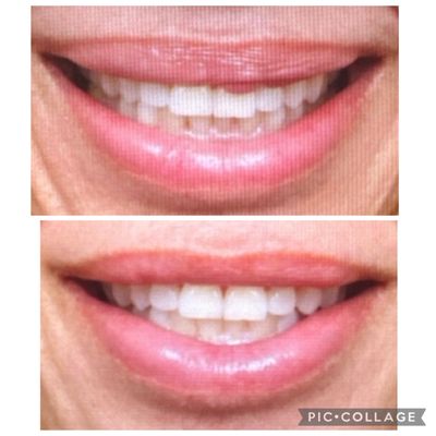 WILLIAM HARRIS - HARRIS FACIAL PLASTIC SURGERY & AESTHETICS,MD ...