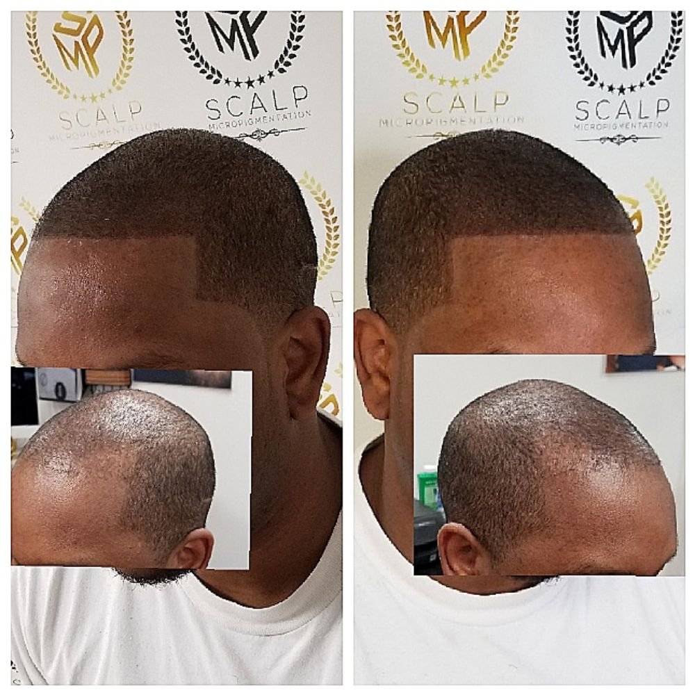 Top 10 Best Scalp Micropigmentation (Smp) in Rockville, MD - Last ...