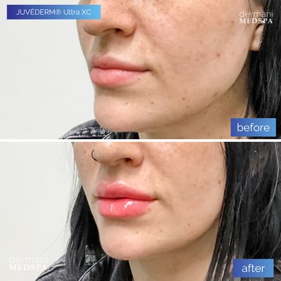 DERMANI MEDSPA - Updated August 2025 - 78 Photos & 57 Reviews - 11720 ...