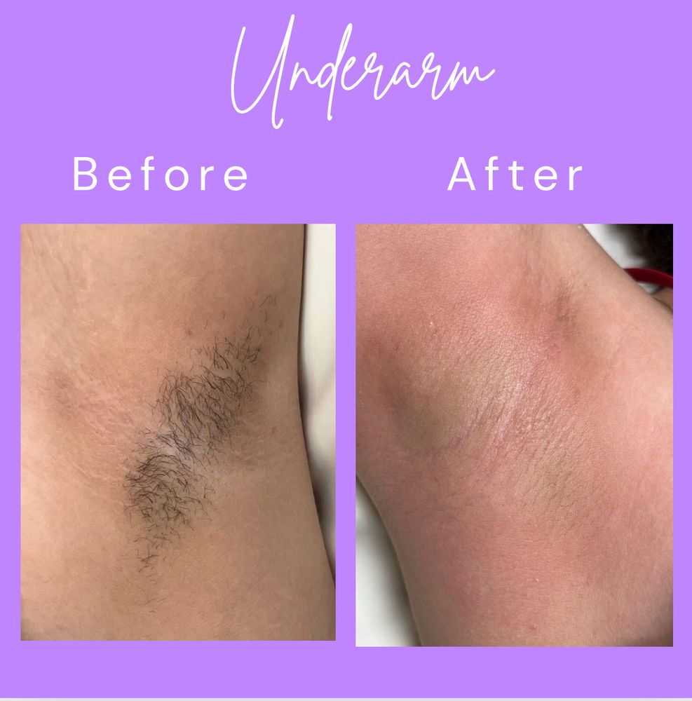 SKINTIMATE WAX STUDIO & FACIALS - Updated December 2024 - Request an ...