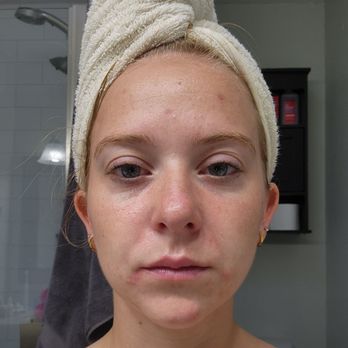 HI, SKIN - Updated September 2025 - 58 Photos & 74 Reviews - 100 E ...