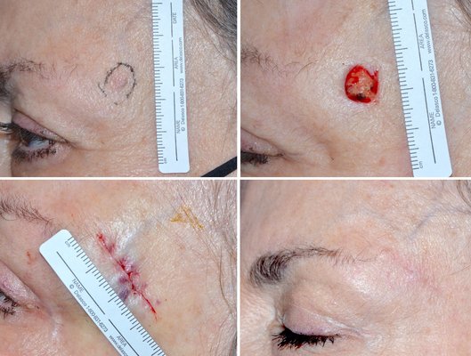 ADAM M ROTUNDA, MD - Updated September 2025 - 72 Photos & 100 Reviews ...