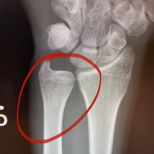 OCOM IMAGING - Updated July 2025 - 10 Reviews - 13301 N Meridian Ave ...