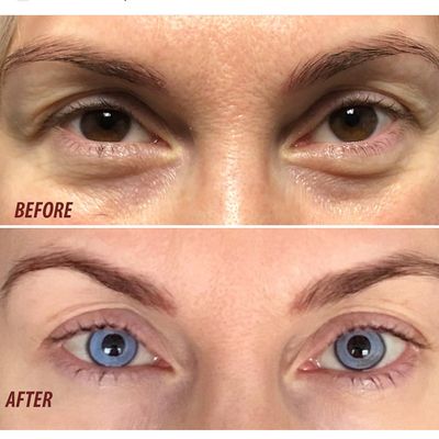 KERATO-NEW YORK - Updated July 2024 - 39 Photos & 22 Reviews - 160 E ...