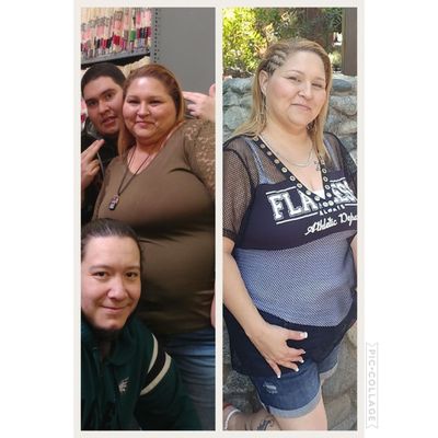 ATIF IQBAL MD - NEW LIFE SURGERY - Updated October 2025 - 56 Photos ...