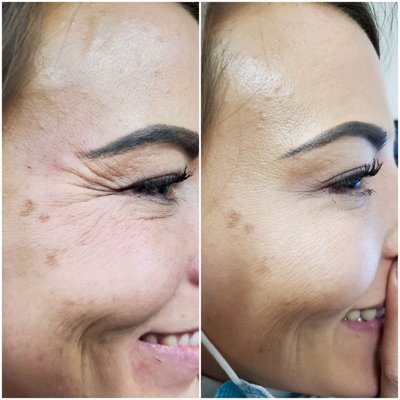 MIDSTATE SKIN INSTITUTE - Updated December 2025 - 34 Photos & 15 ...