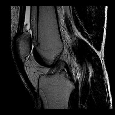 PREFERRED OPEN MRI - Updated November 2025 - 14 Photos - 4200 W 63rd St ...
