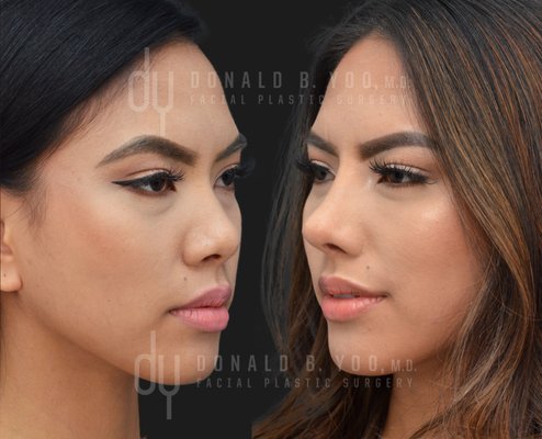 DONALD B YOO, MD, FACS - Updated December 2025 - 378 Photos & 249 ...