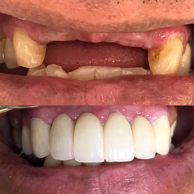 JENIFER B. LABRADOR, DDS - Updated May 2026 - 32 Photos & 52 Reviews ...