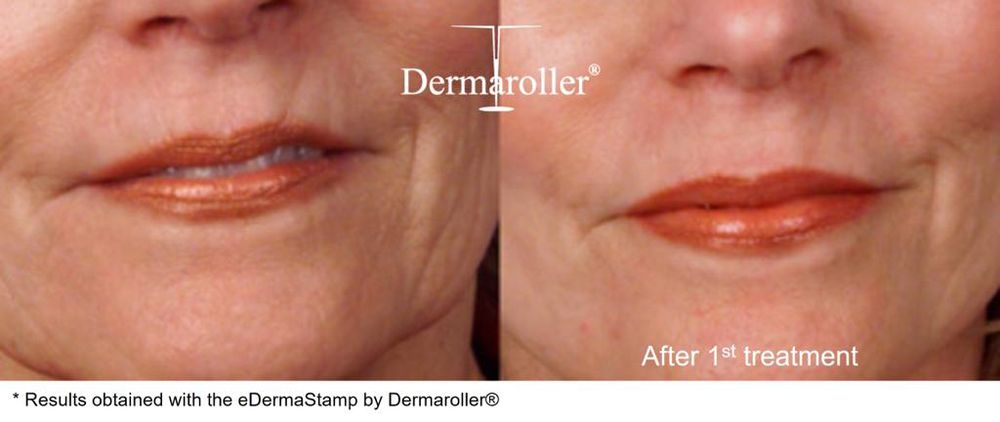 SAMRA LASER HAIR REMOVAL AND SKIN REJUVENATION - Updated December 2024 ...