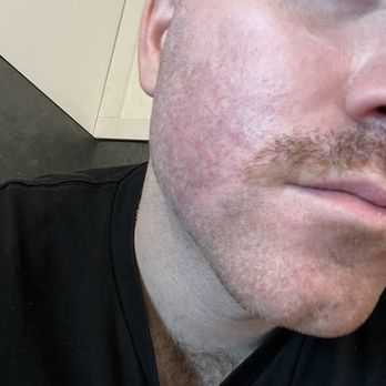 JASON EMER, MD - Updated December 2025 - 1166 Photos & 520 Reviews ...