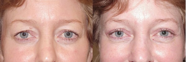 KIMBERLY HENRY, MD - Updated May 2026 - 114 Photos & 18 Reviews - 715 ...