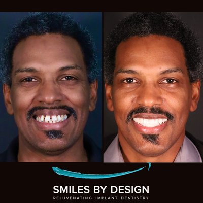SMILES BY DESIGN - REJUVENATING IMPLANT DENTISTRY - Updated May 2026 ...