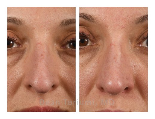 DEAN TORIUMI, MD - Updated May 2026 - 58 Photos & 50 Reviews - 60 E ...