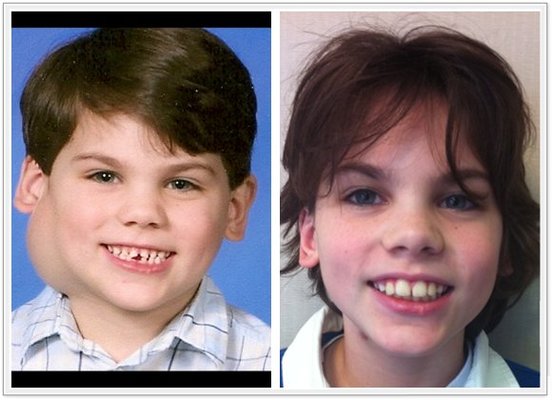 THE VASCULAR BIRTHMARK CENTER - GREGORY M. LEVITIN, MD - Updated ...