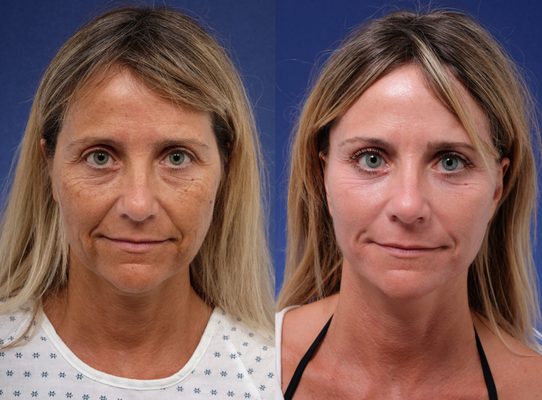 STEIGER FACIAL PLASTIC SURGERY: DR. JACOB D. STEIGER - Updated December ...