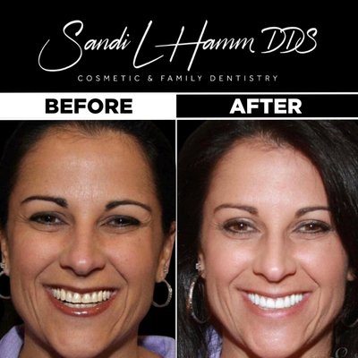 SANDI L. HAMM, DDS - Updated May 2025 - 60 Photos - 1833 Cannon Dr ...
